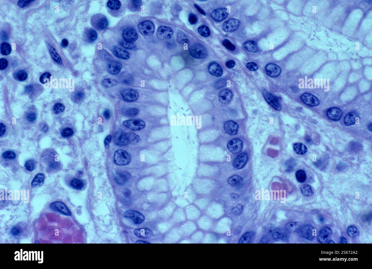 Light micrograph of a section of stomach tissue showing helicobacter ...