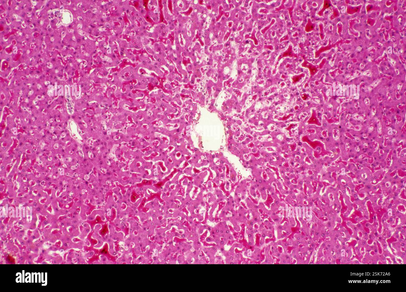 Light micrograph of a section of liver showing congestion of the ...