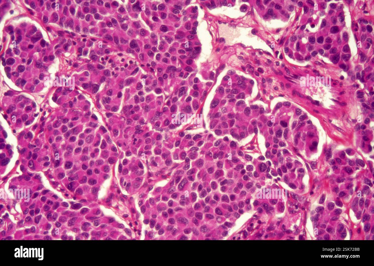 Light micrograph of a section of the thyroid gland with medullary ...