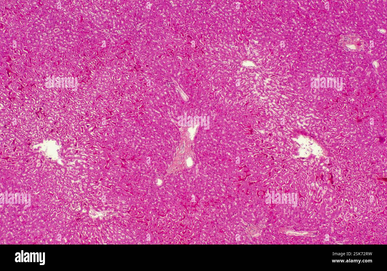 Light micrograph of a section of liver showing congestion of the ...