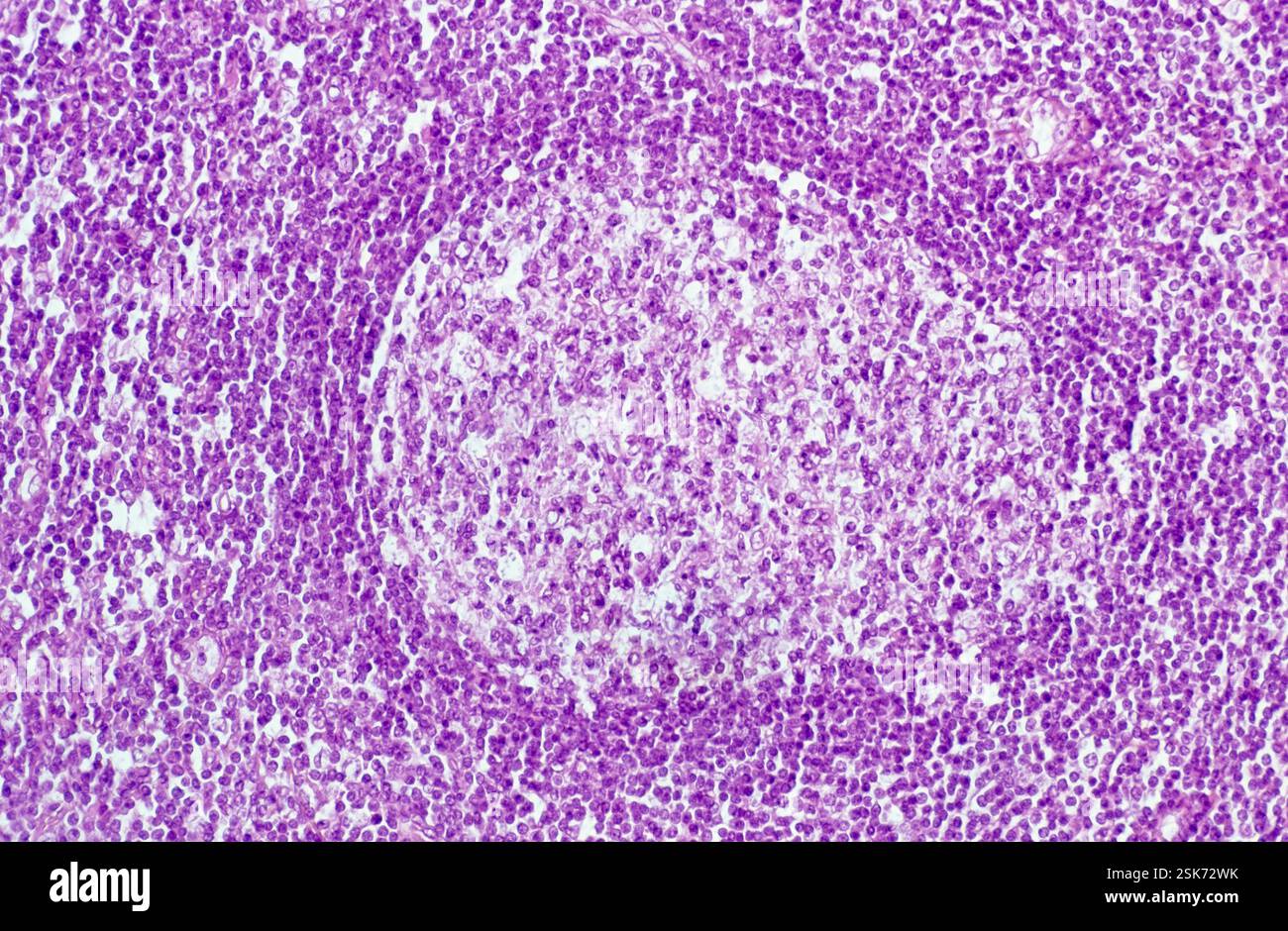 Light micrograph of a germinal centre (pale, centre) within a healthy ...