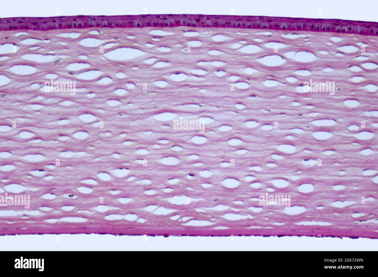 Coloured light micrograph of a healthy human cornea, the transparent ...