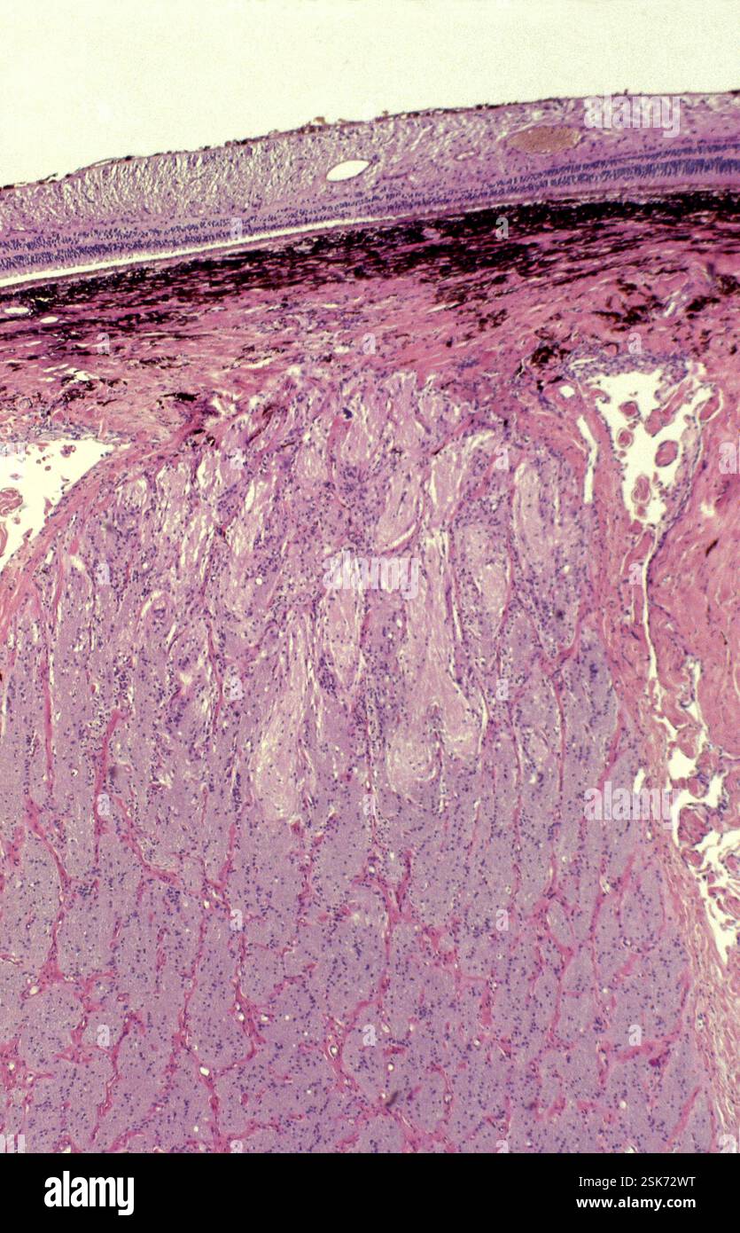 Coloured light micrograph of healthy human eye tissue, including the ...