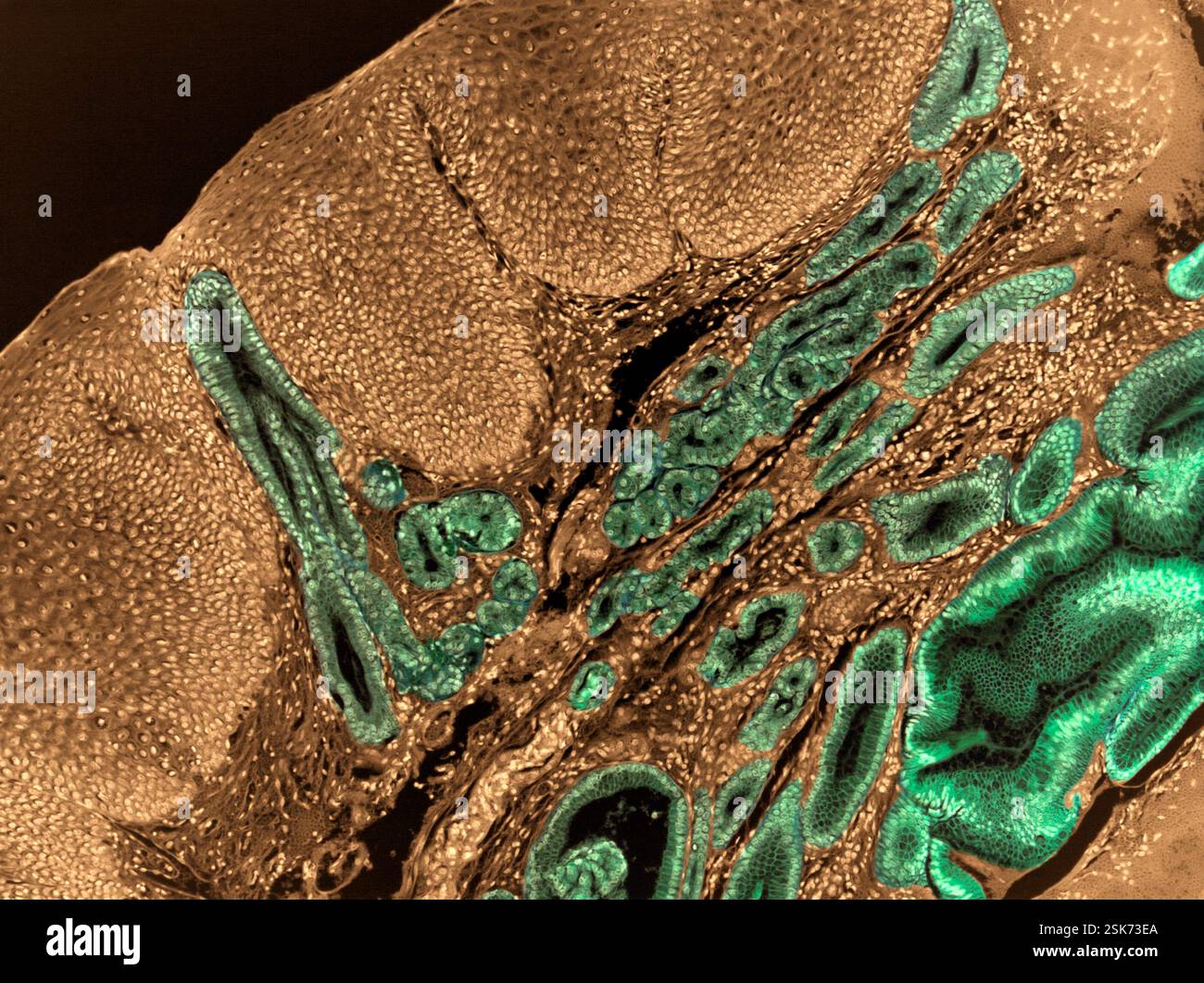 Normal lumbar spine, 3D CT scan Stock Photo - Alamy