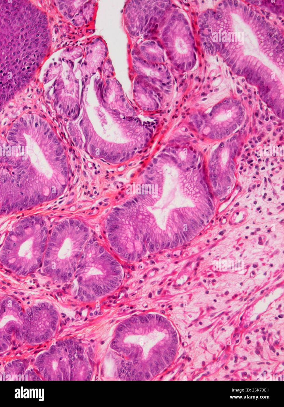 Normal lumbar spine, 3D CT scan Stock Photo - Alamy