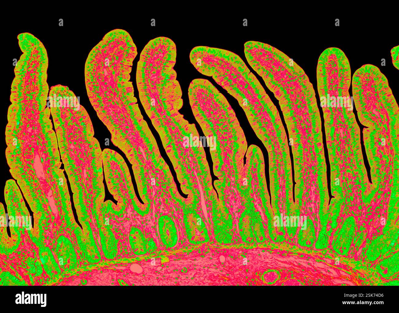 Small intestine. Light micrograph of a section through the duodenum ...