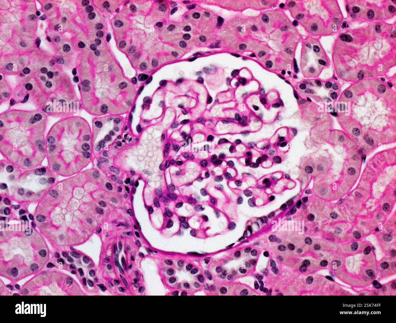 Kidney glomerulus. Kidney glomerulus, light micrograph. This section ...
