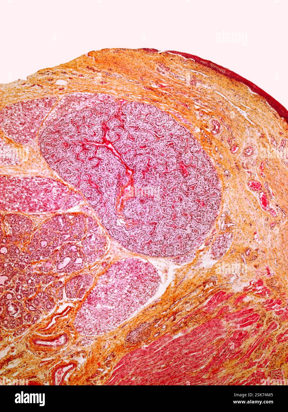 Normal parathyroid gland, micrograph of a section through a healthy ...