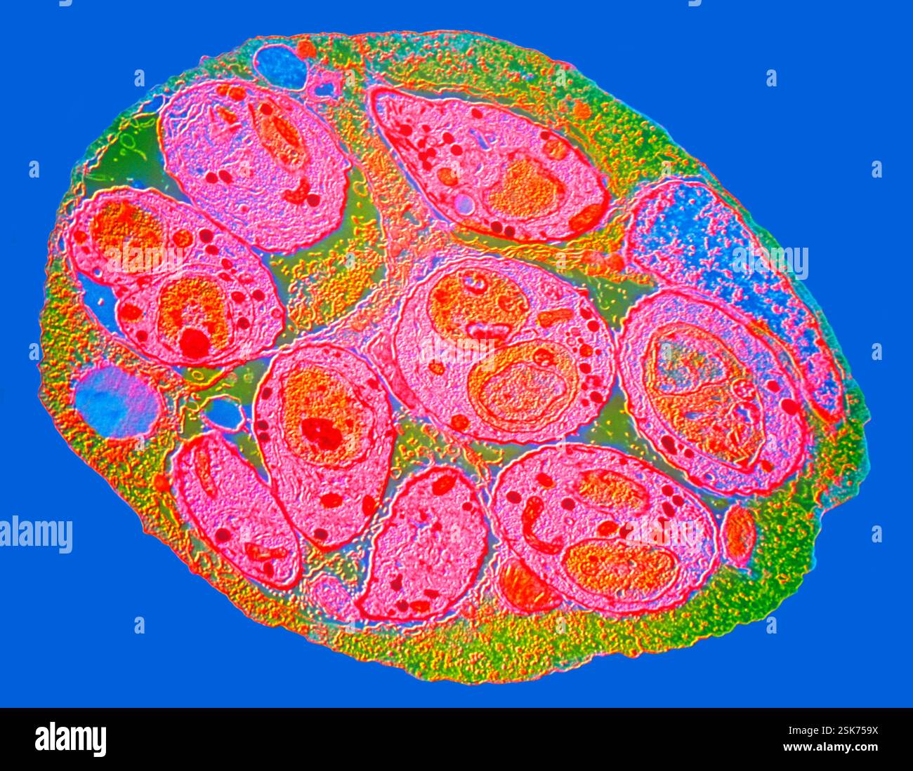 Toxoplasma infected cell. Coloured transmission electron micrograph ...