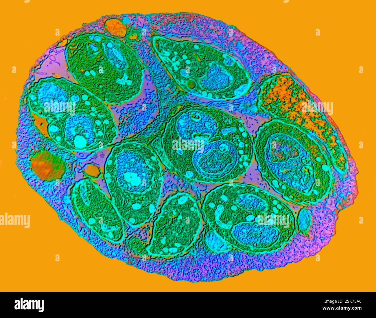 Toxoplasma infected cell. Coloured transmission electron micrograph ...