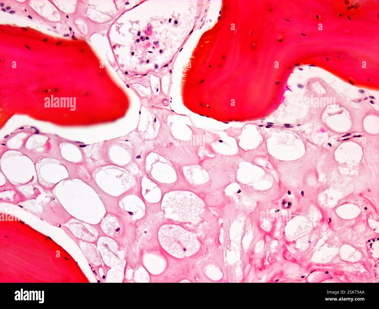 Normal bone marrow. Light micrograph of a section through healthy ...