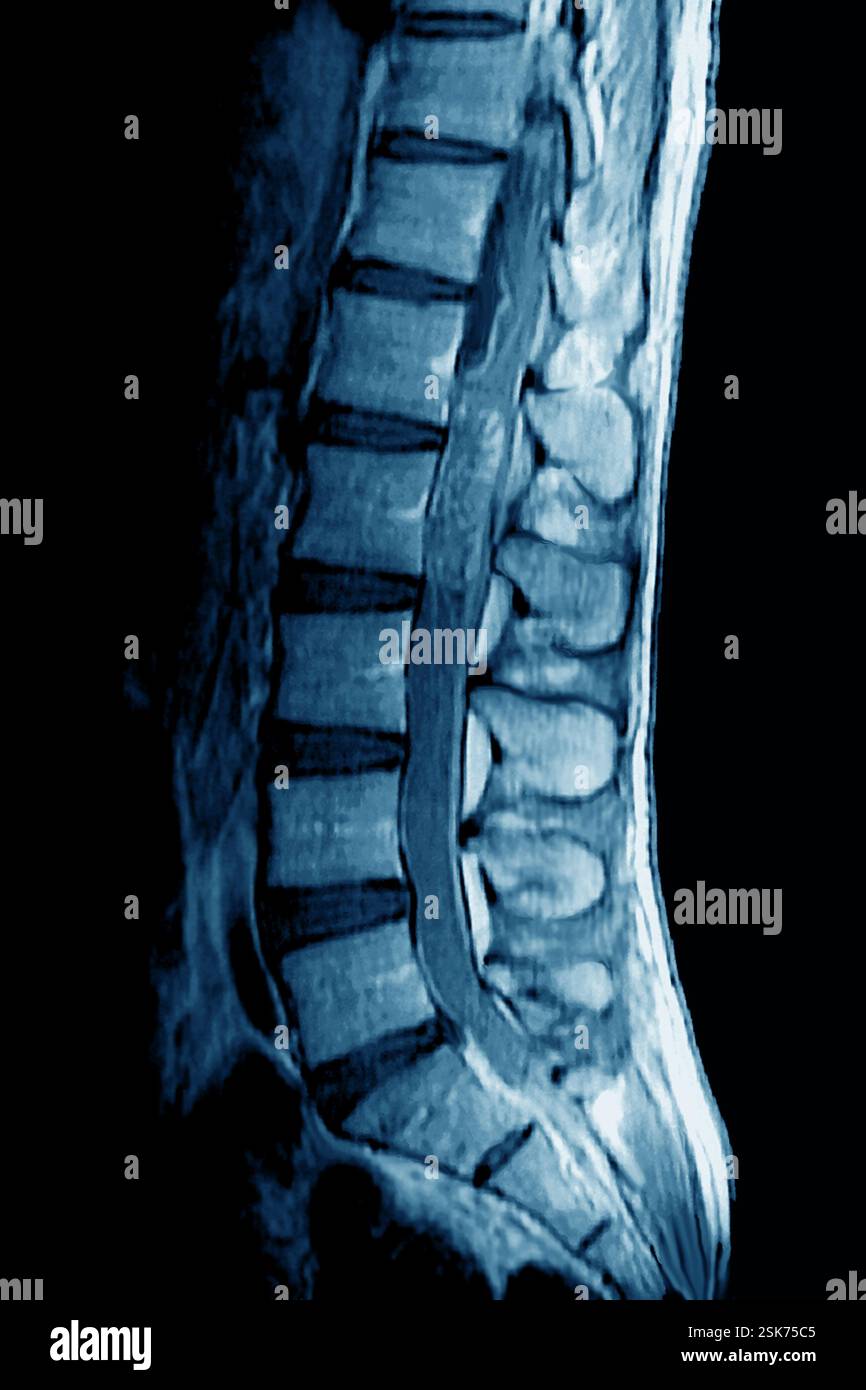 Dyslexic and normal brain during reading Stock Photo - Alamy