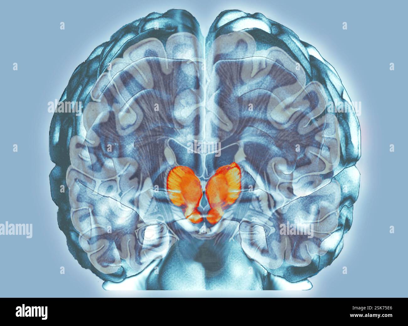 Putamen of the brain, coloured 3-D magnetic resonance imaging (MRI ...