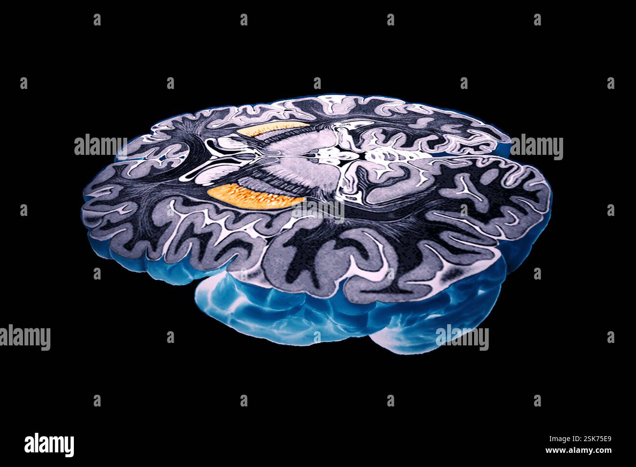 Putamen of the brain, coloured 3-D magnetic resonance imaging (MRI ...