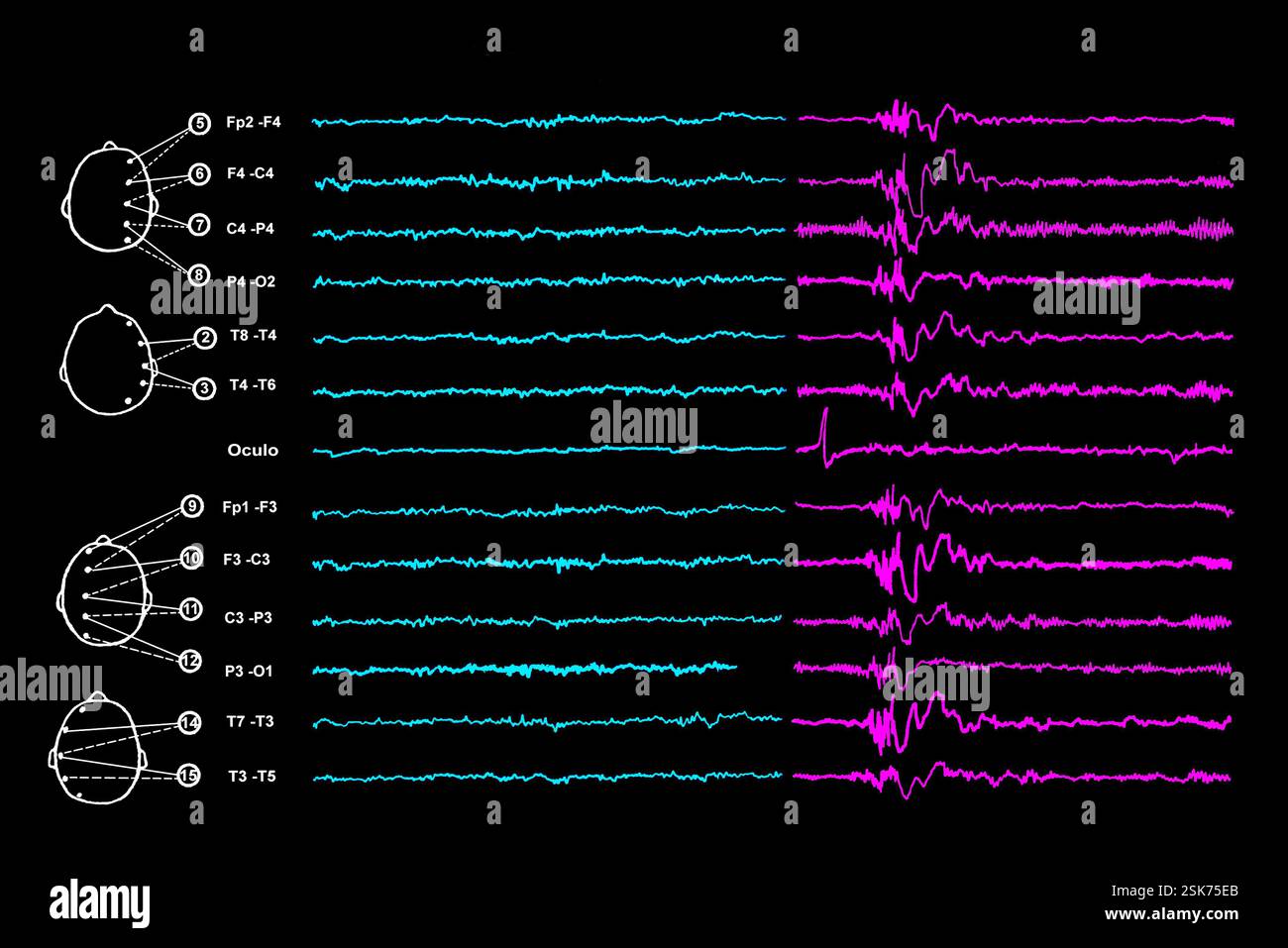 Brain waves during sleep Stock Photo - Alamy