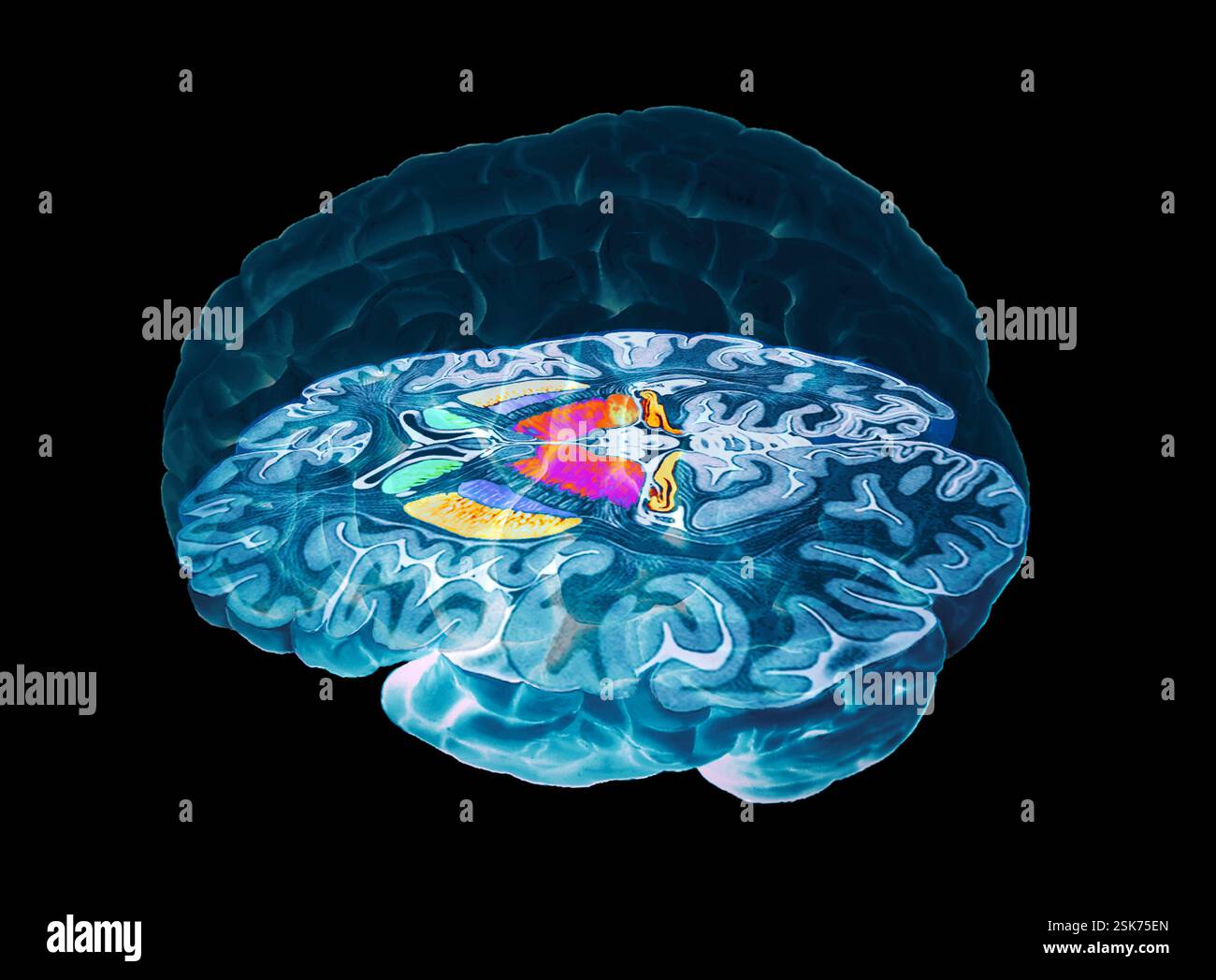Basal ganglia of the brain, coloured 3-D magnetic resonance imaging (MRI) scan. The brain is ...
