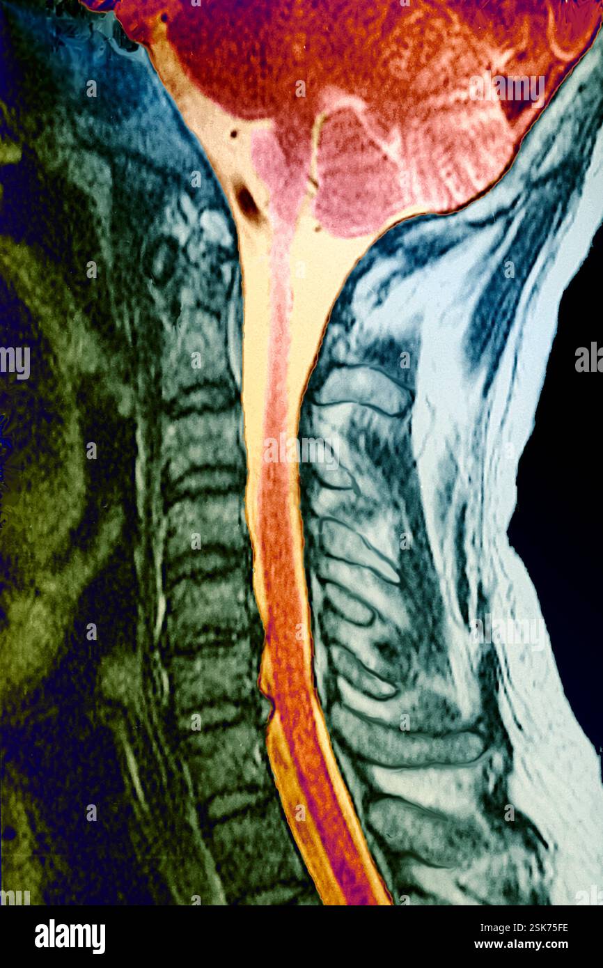 Xenopus frog embryo, four-cell stage Stock Photo - Alamy