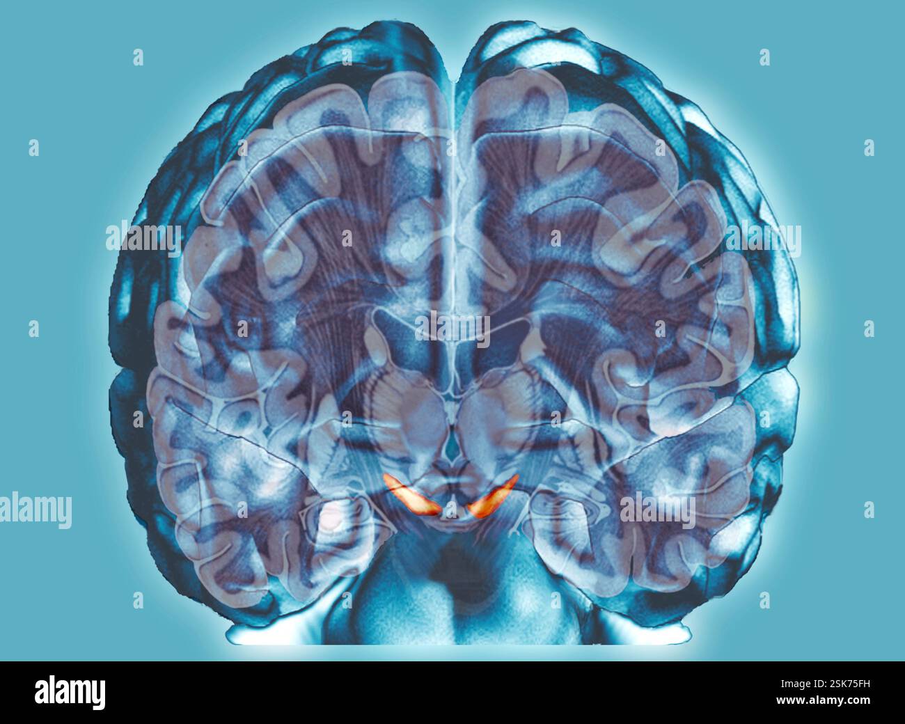 Caudate nucleus of the brain, coloured 3-D magnetic resonance imaging (MRI) scan. The brain is ...