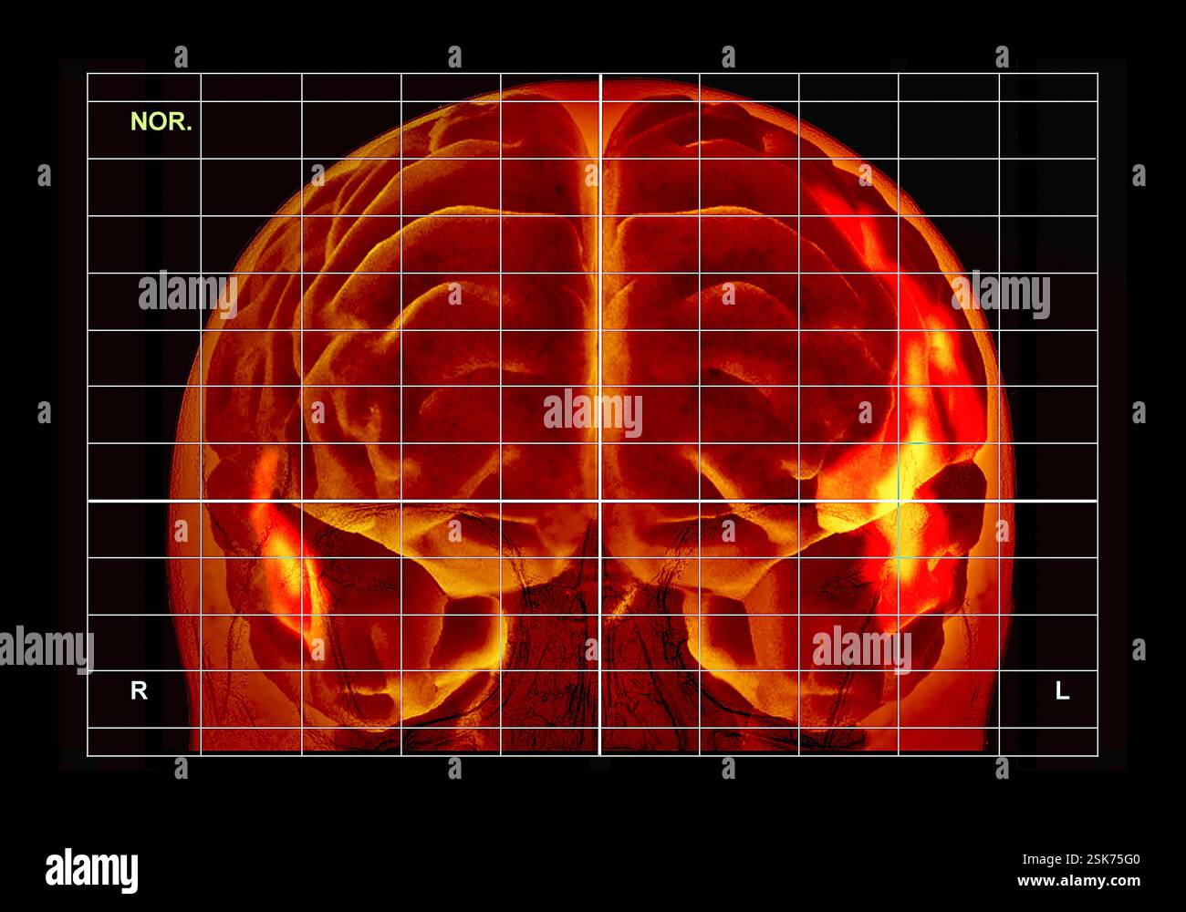 Brain activity during reading aloud. This is a composite of a 3-D ...