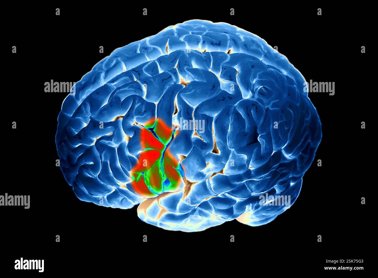 Brain activity during thinking about words. This is a composite of a 3 ...