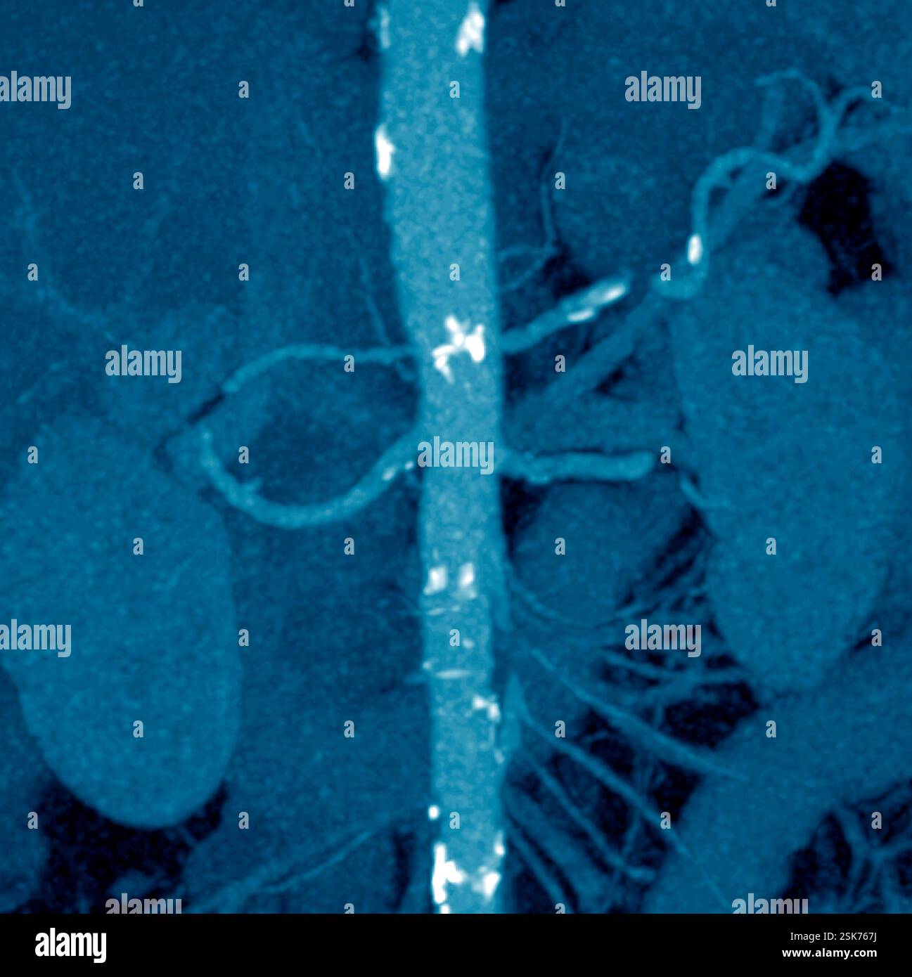 Healthy child's brain, 3-D MRI scan Stock Photo - Alamy
