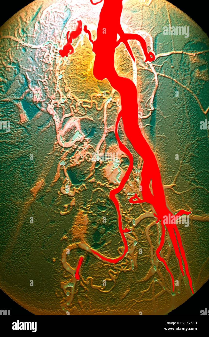 Lower spine, 3D CT scan Stock Photo - Alamy