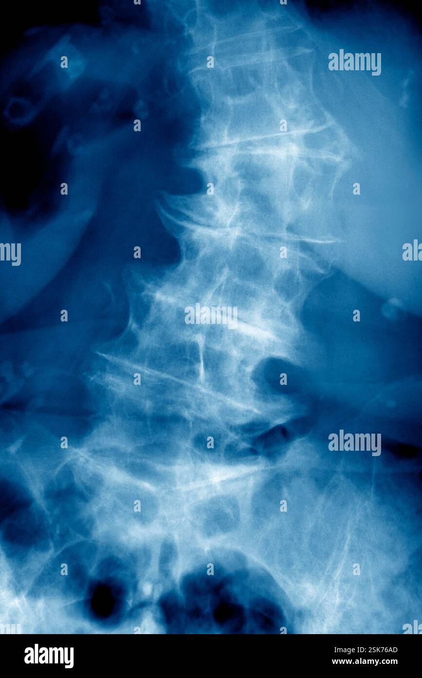 Euglena flagellate protozoa Stock Photo - Alamy