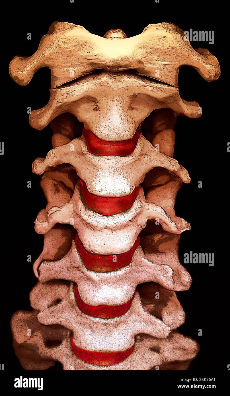 Neck bones, 3D CT scan Stock Photo - Alamy