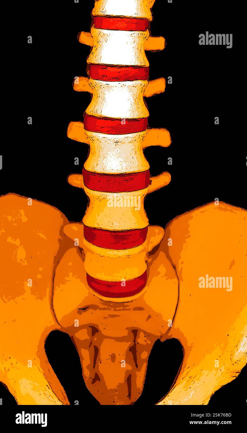 Lower spine, 3D CT scan Stock Photo - Alamy