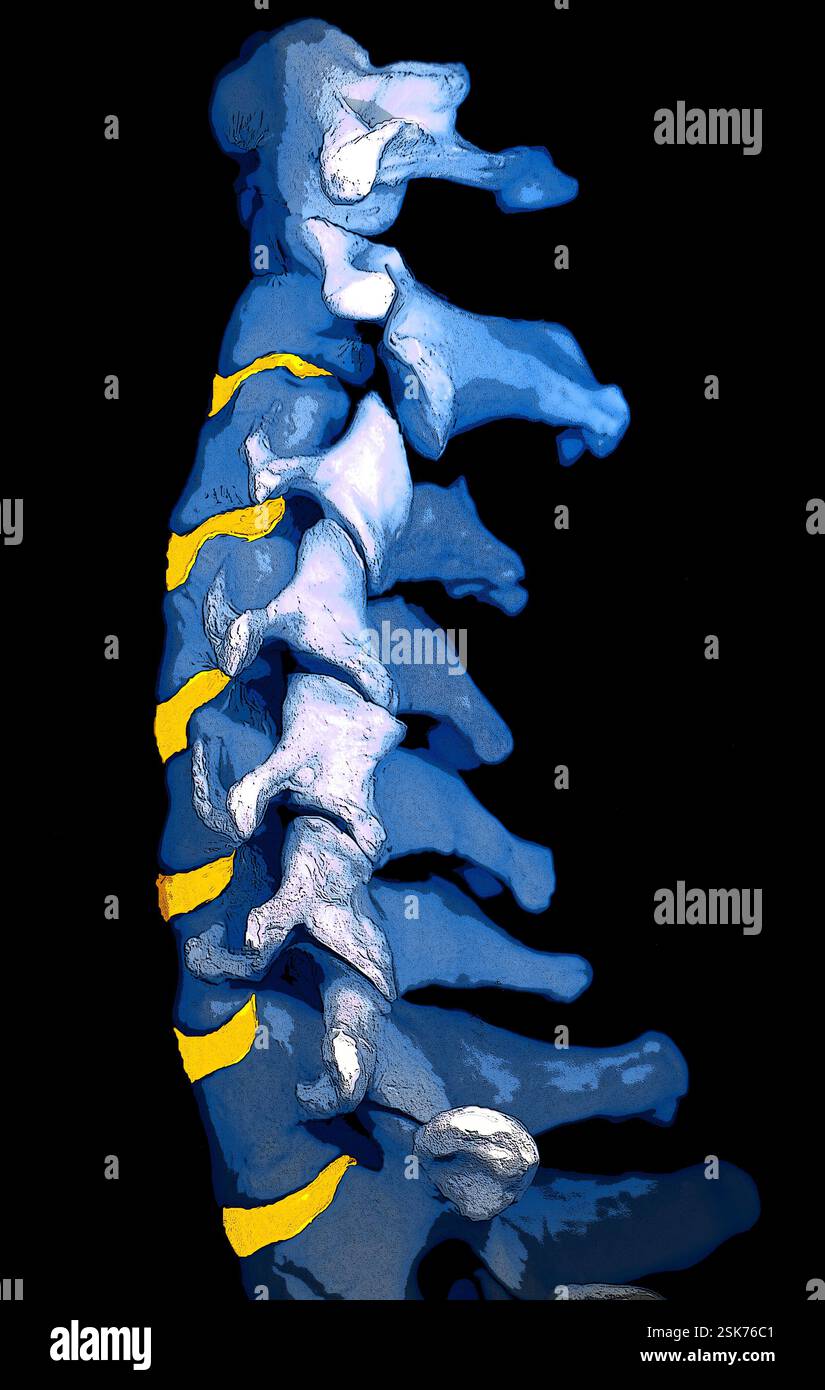 Neck bones, 3D CT scan Stock Photo - Alamy