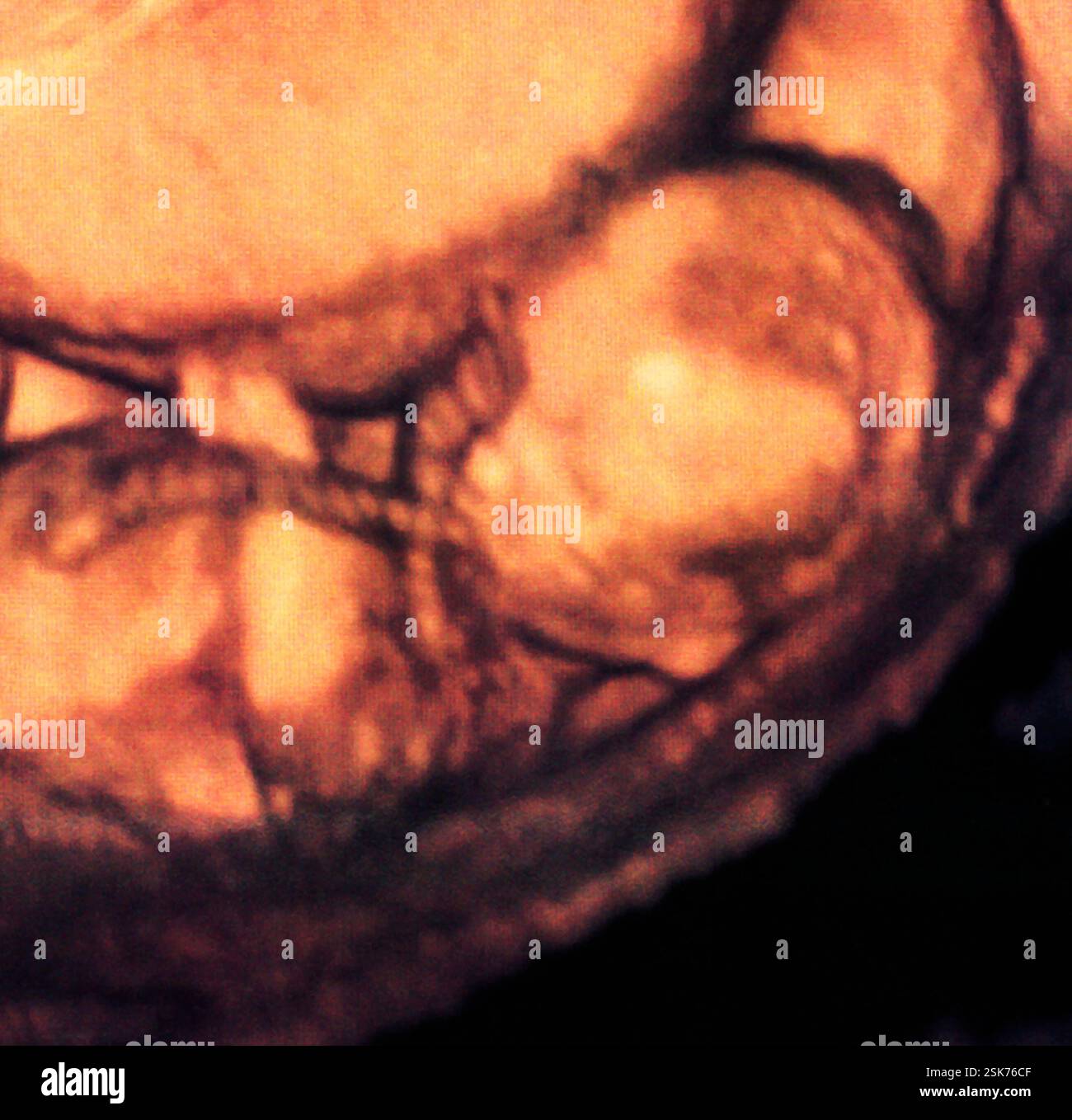 12 week old foetus, ultrasound scan Stock Photo - Alamy
