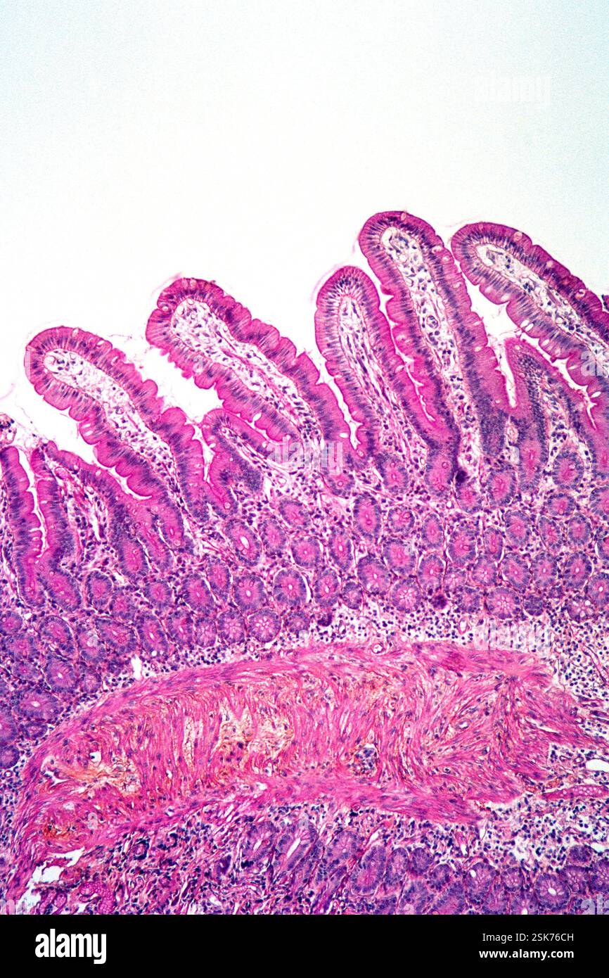 Small intestine. Light micrograph of a section through the duodenum ...