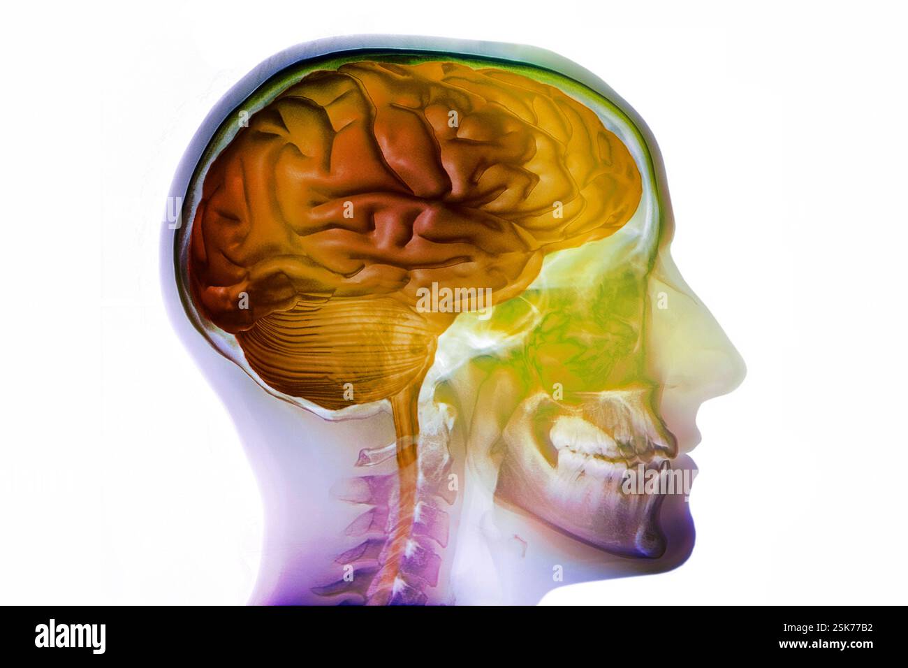 Coloured three-dimensional (3D) Magnetic Resonance Imaging (MRI) scan in side view of a healthy ...