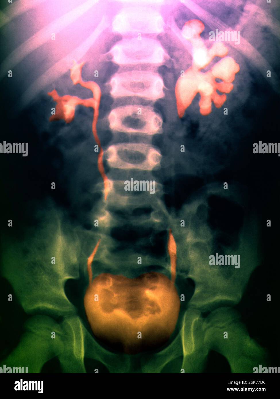 Pyramidal nerve cells Stock Photo - Alamy