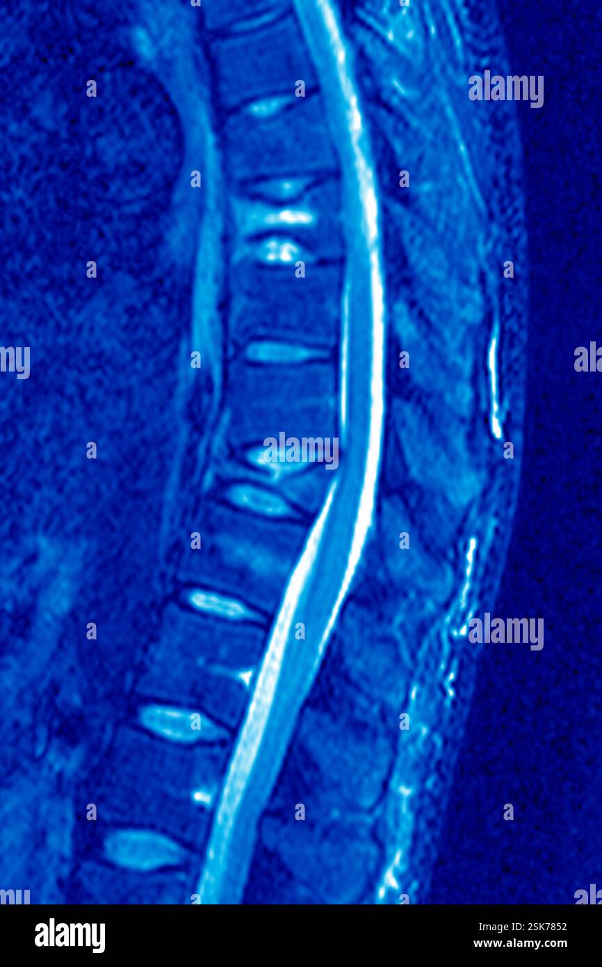 Coloured Magnetic Resonance Imaging (MRI) scan in sagittal section ...