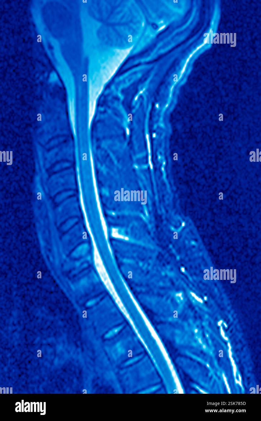 Coloured Magnetic Resonance Imaging (MRI) scan in sagittal section ...
