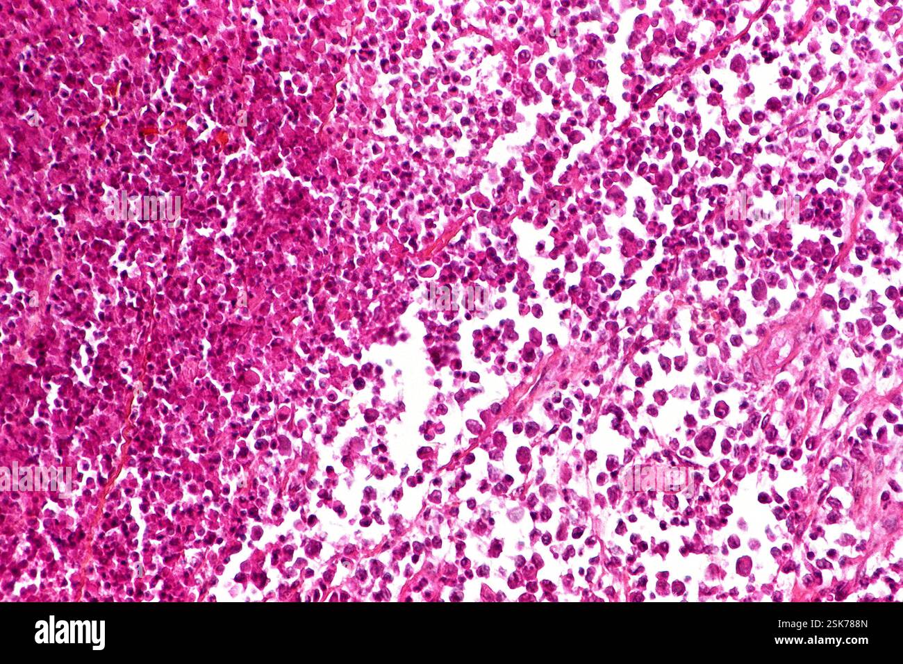 Light micrograph of a section through the skin, showing cutaneous ...