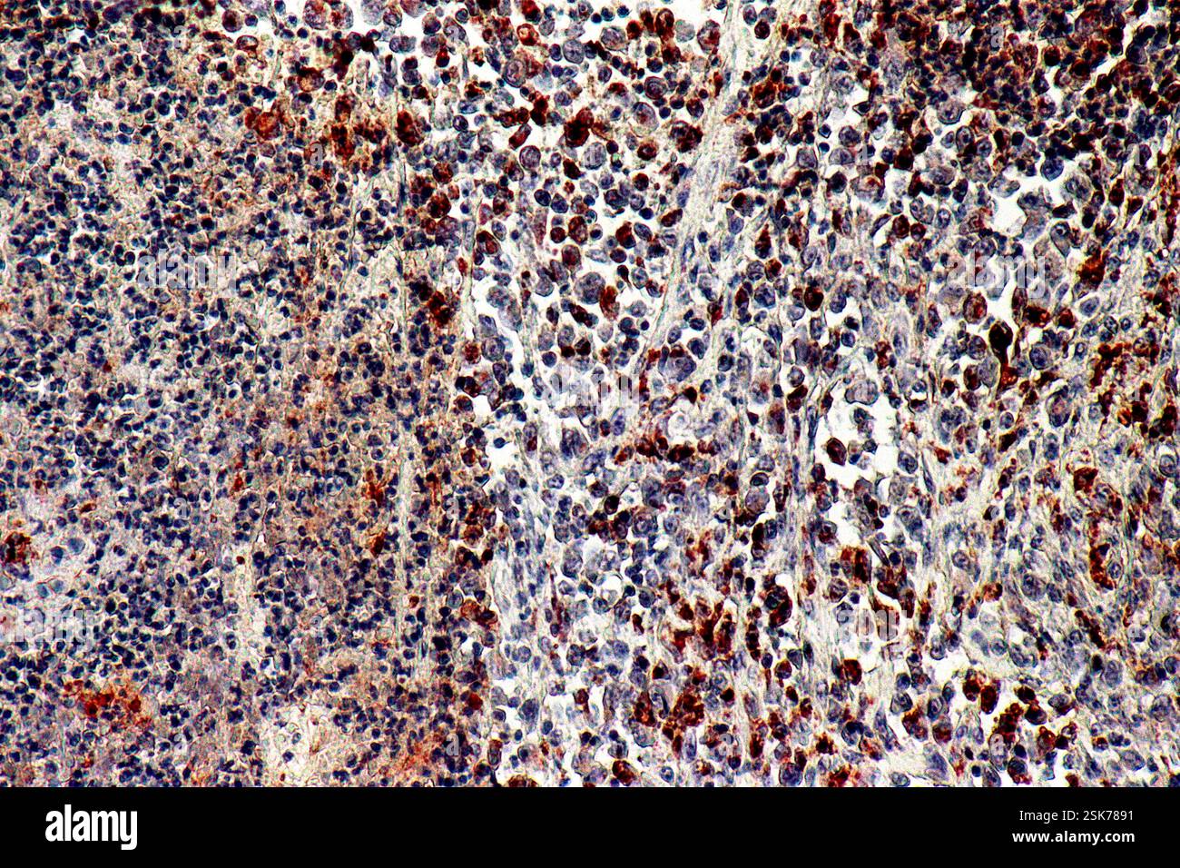 Light micrograph of a section through the skin, showing cutaneous ...