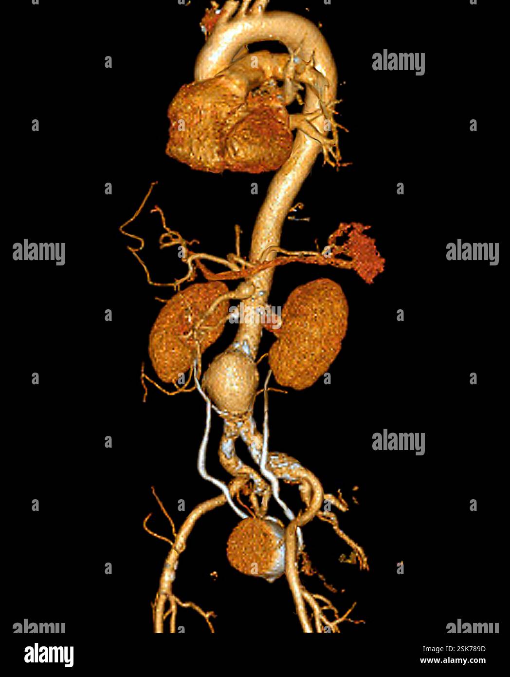 Three dimensional Computed Tomography (CT) angio scan in anterior ...