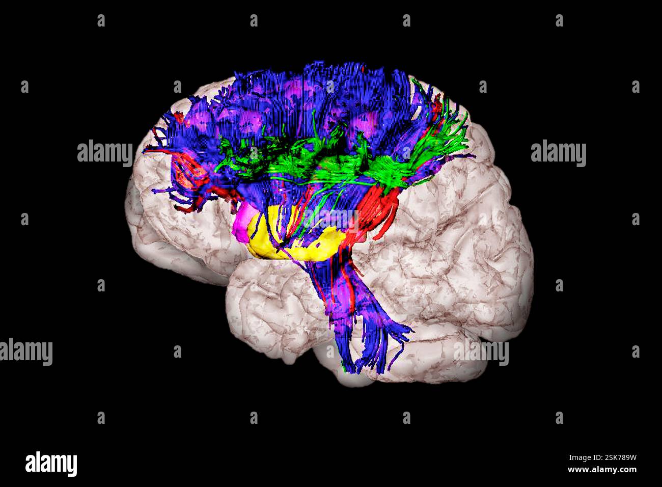 Coloured Three Dimensional Diffusion Tensor Imaging Dti Scan In Side View Through The Brain