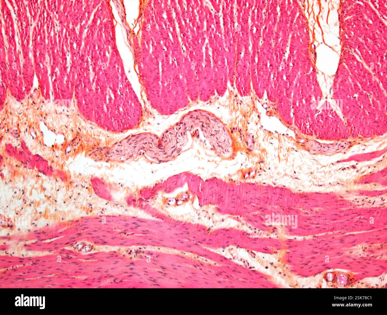 Light micrograph of a section through the enlarged wall of the large ...