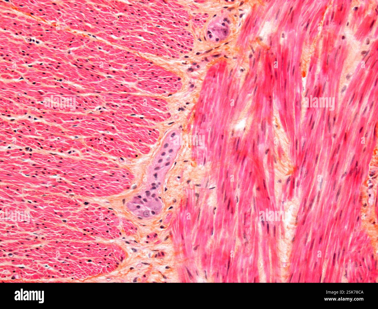 Light micrograph of a section through the wall of the large intestine ...