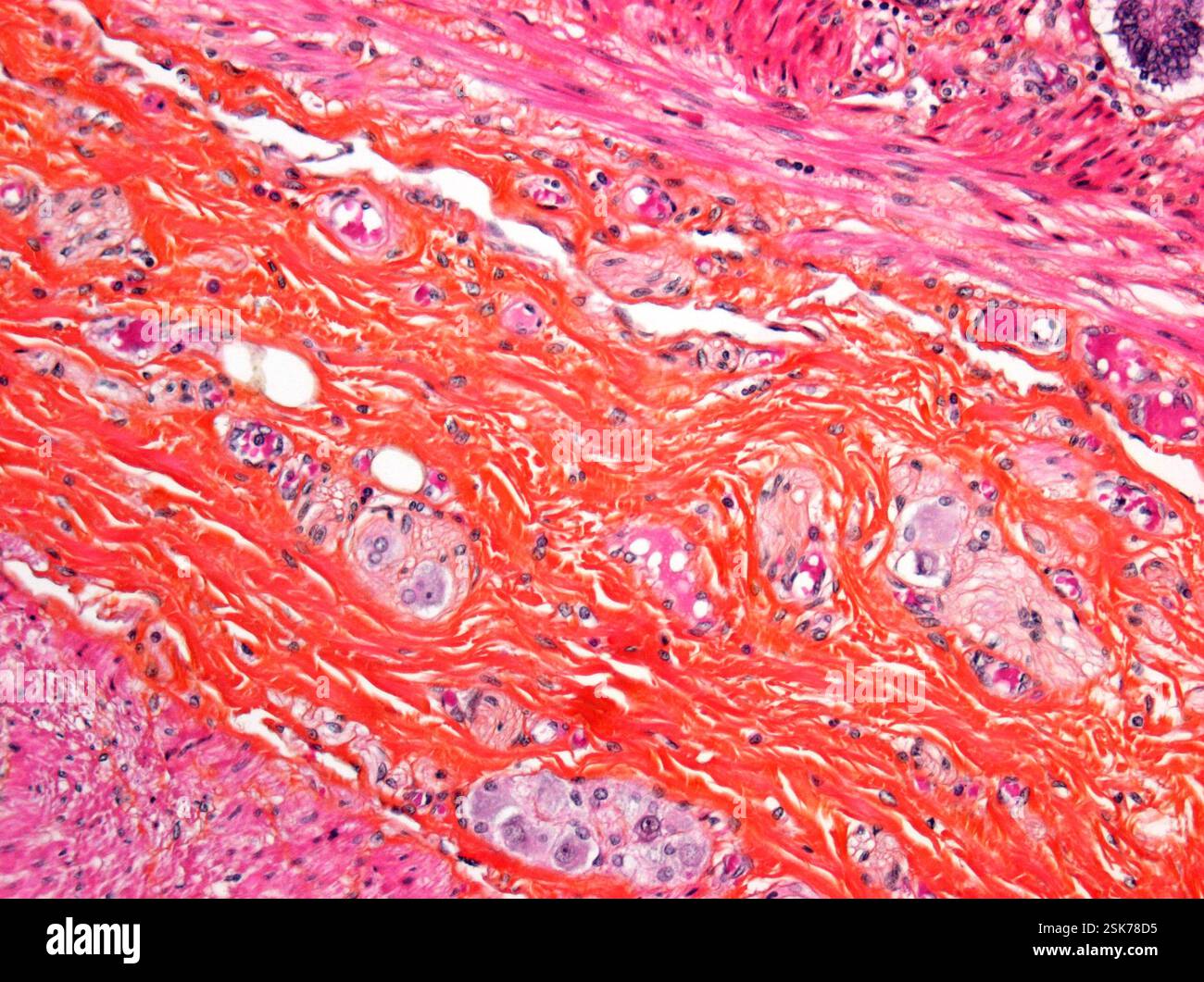 Light micrograph of a section through the wall of the large intestine ...