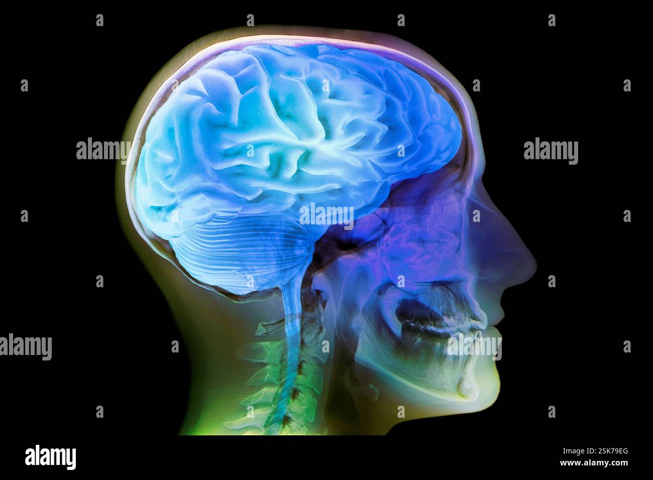 Coloured three-dimensional (3D) Magnetic Resonance Imaging (MRI) scan in side view of a healthy ...