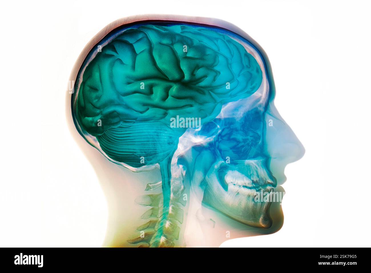 Coloured three-dimensional (3D) Magnetic Resonance Imaging (MRI) scan in side view of a healthy ...