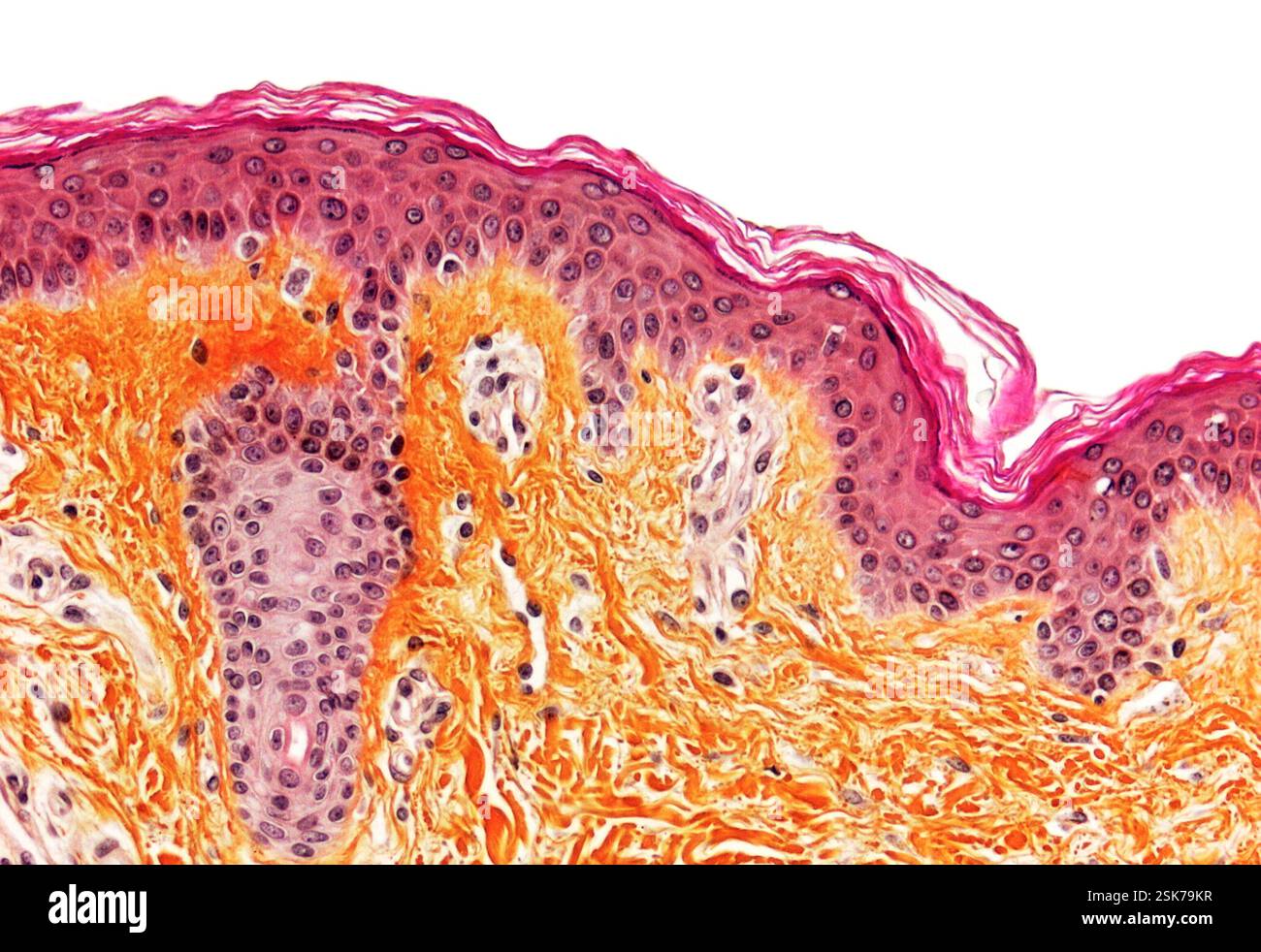 Skin layers. Coloured light micrograph of a section through normal ...