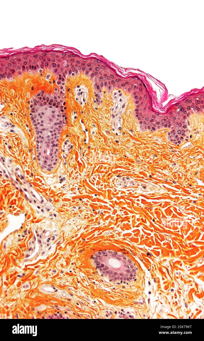 Skin layers. Light micrograph of a section through normal human skin ...