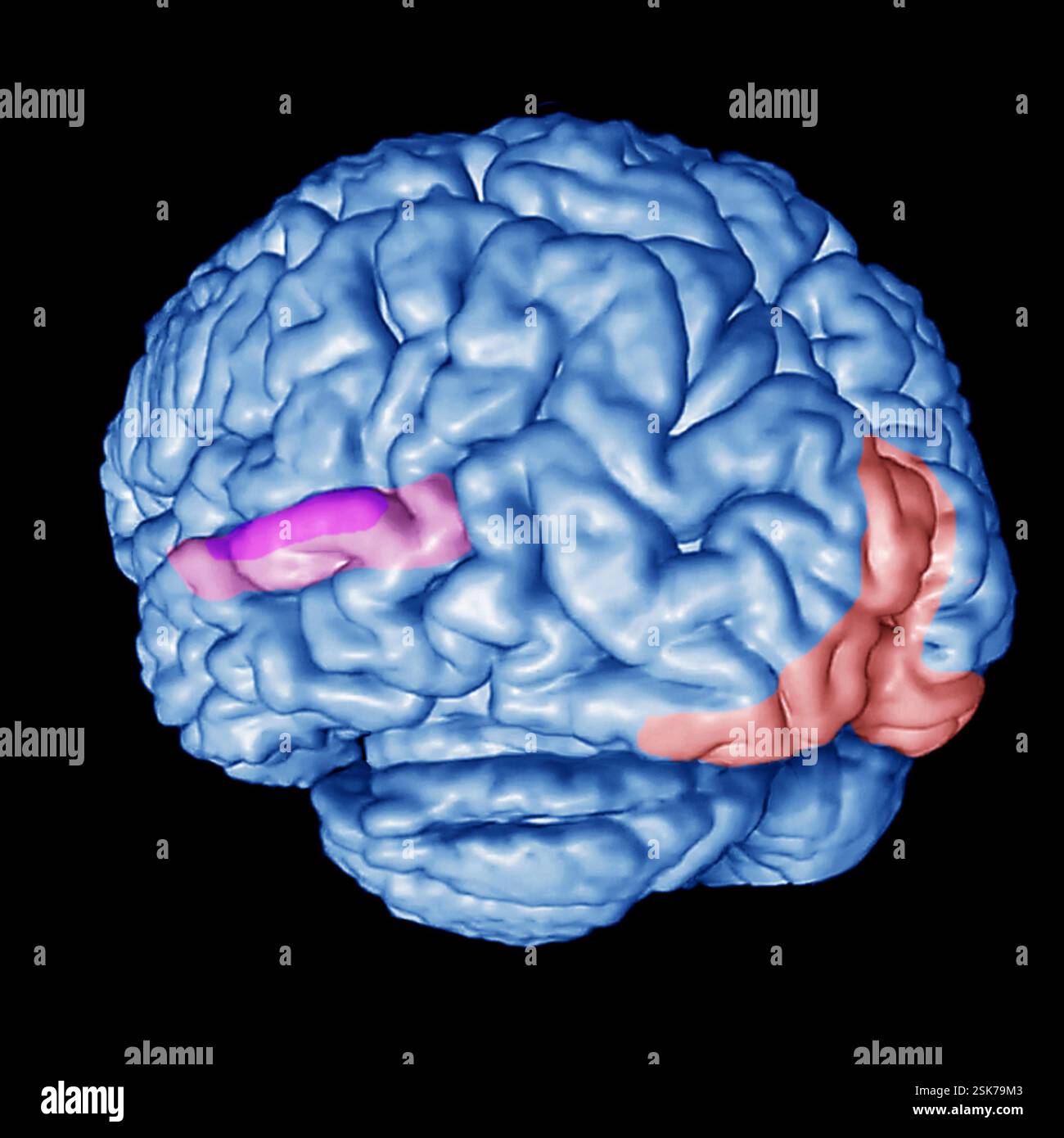 Auditory and visual area brain activation. 3D functional magnetic ...