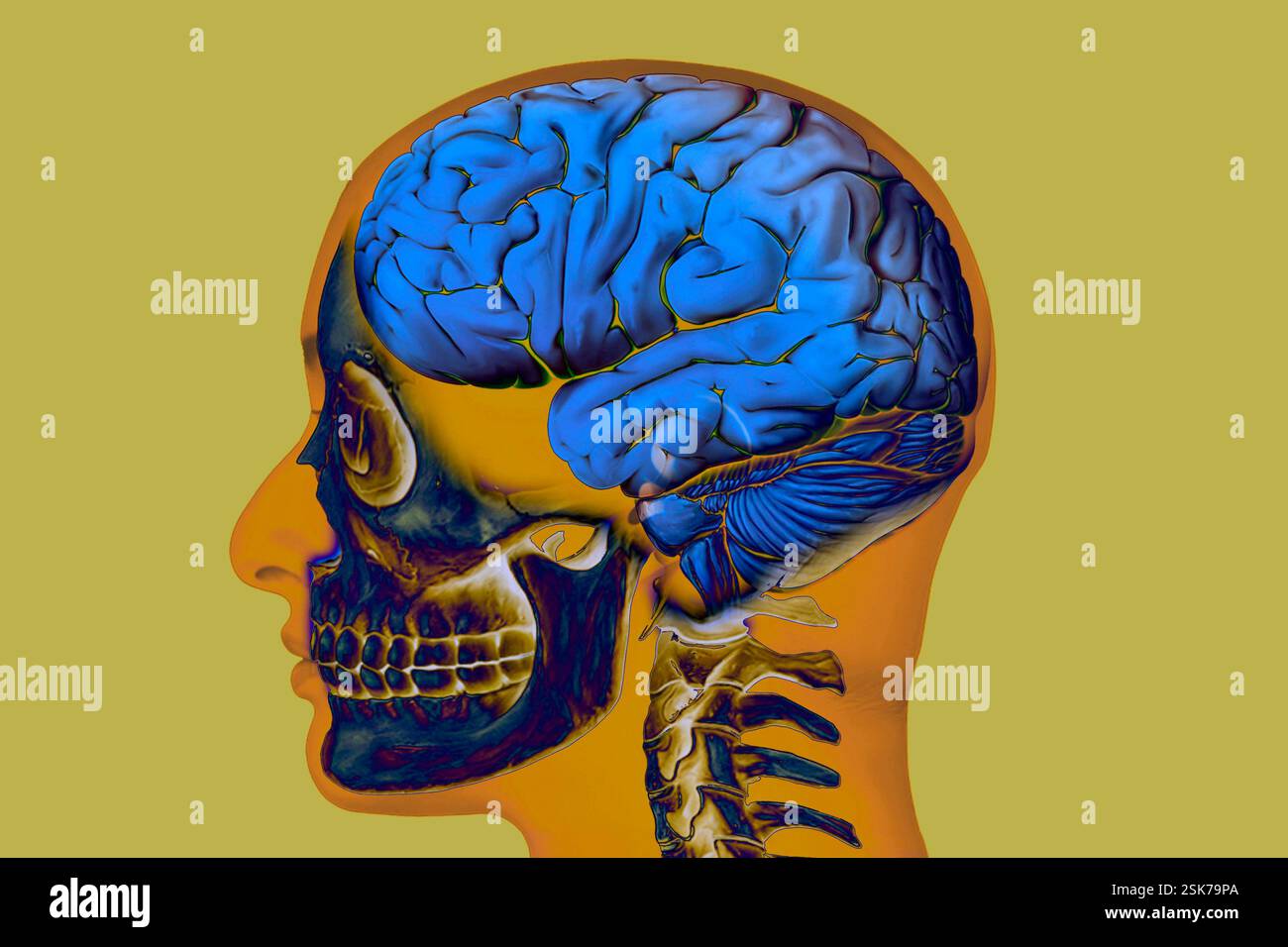 Human head. Coloured composite image of 3D magnetic resonance imaging ...