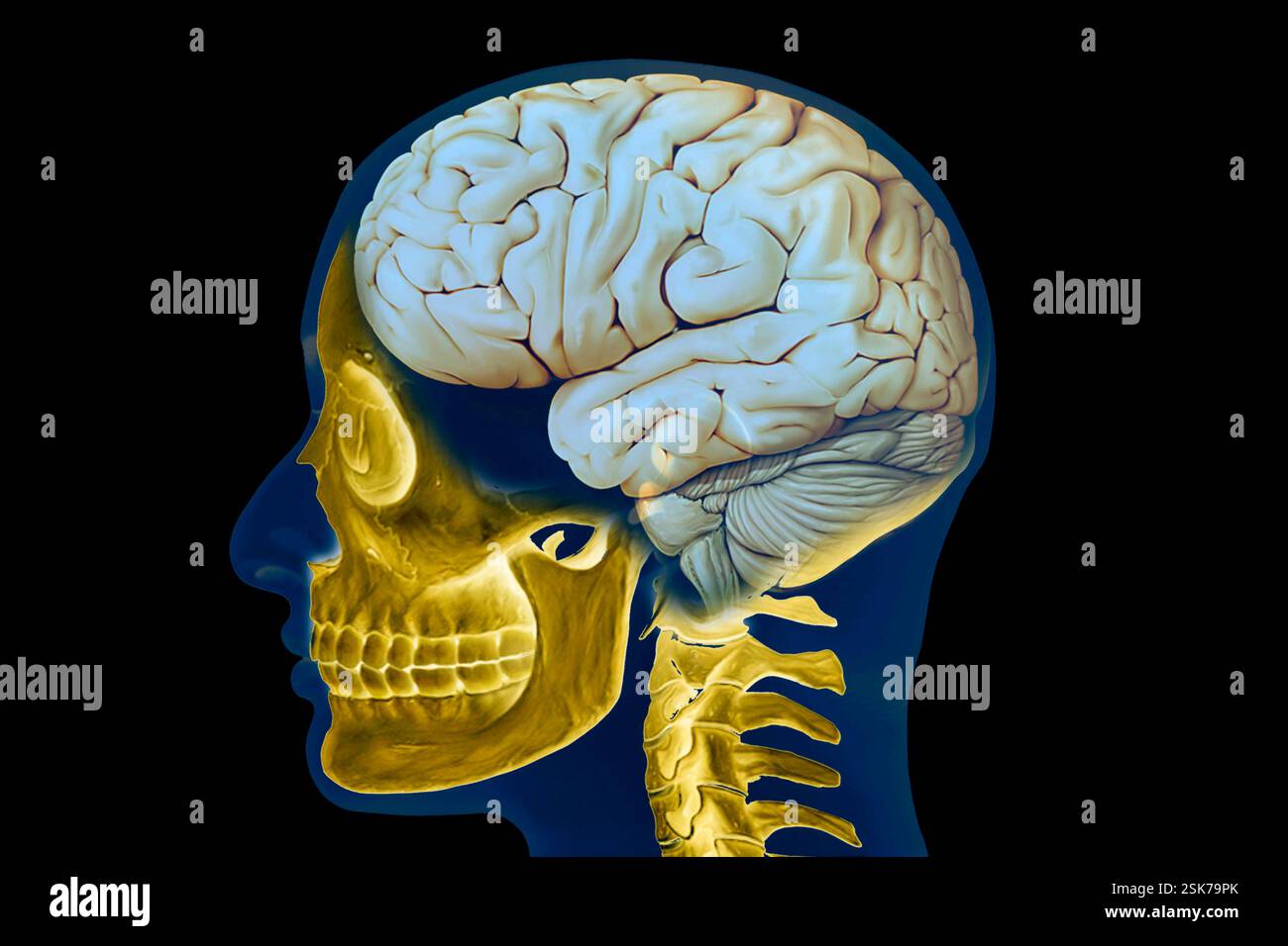 Human head. Coloured composite image of 3D magnetic resonance imaging ...